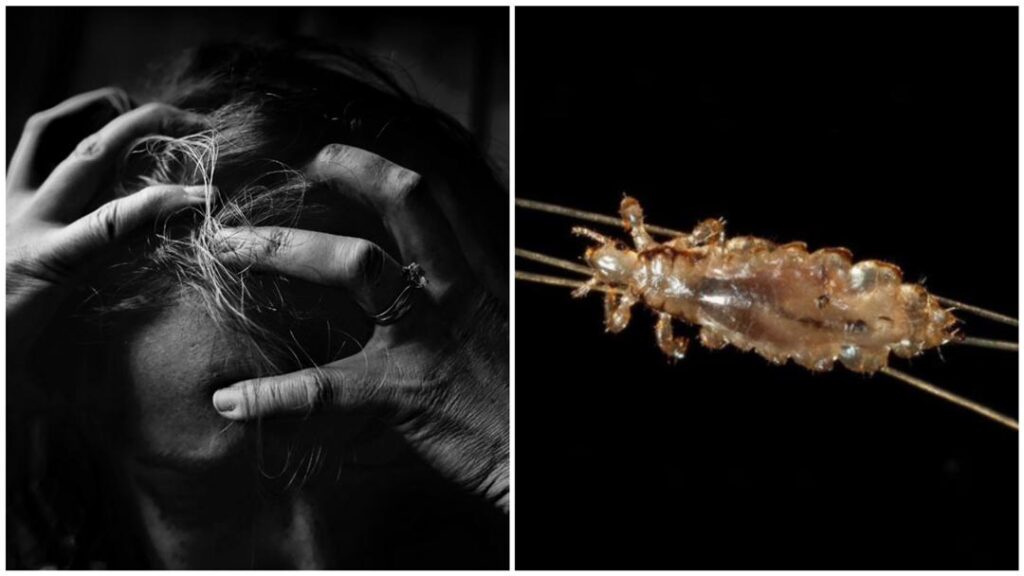 Jenis, kitaran hidup dan cara membasmi, ini 10 fakta tentang kutu - Relevan